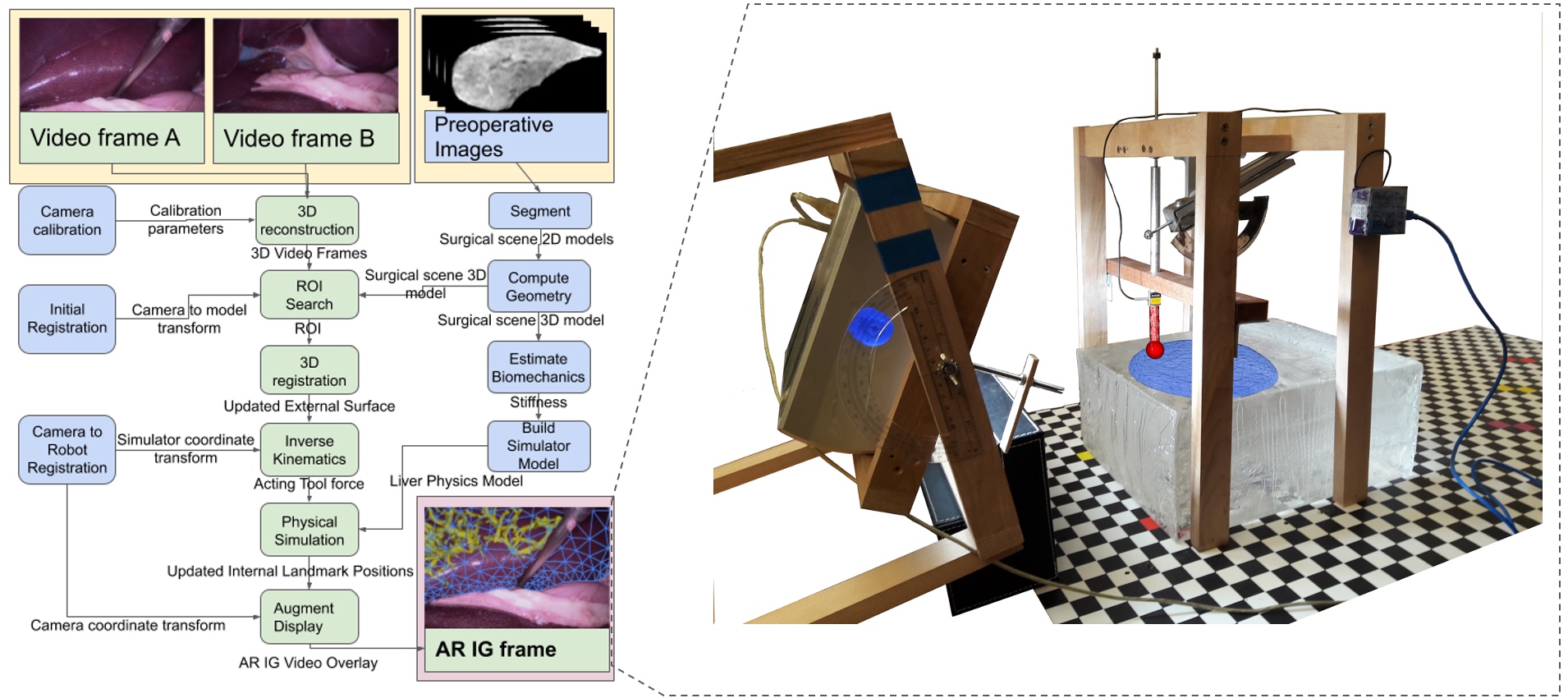 X-Ray Vision: Enhancing Liver Surgery with Augmented Reality | Kastner ...